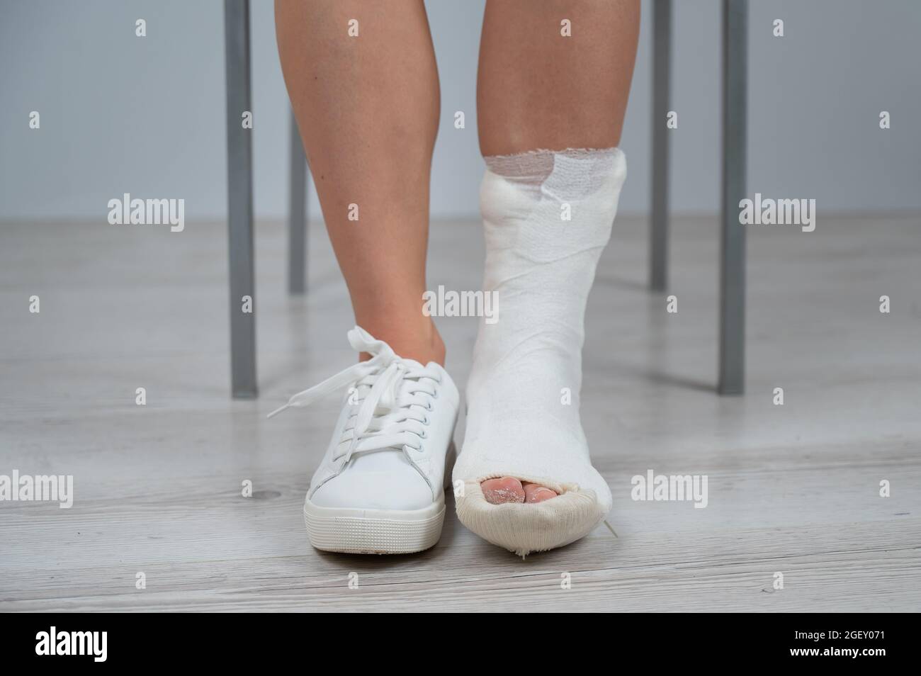 Gips bein gegossene beine -Fotos und -Bildmaterial in hoher Auflösung ...