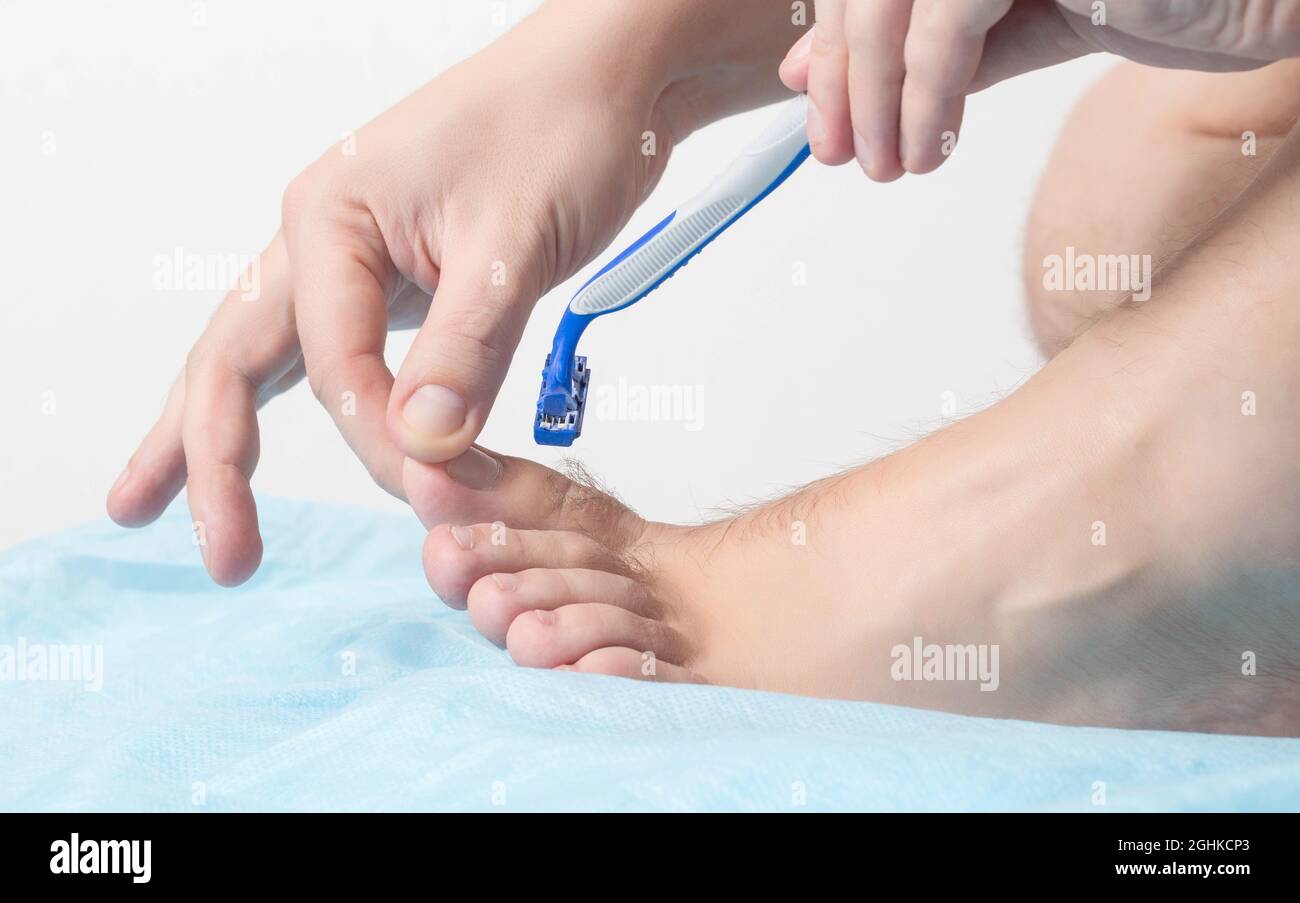 Wachsen haare -Fotos und -Bildmaterial in hoher Auflösung – Alamy