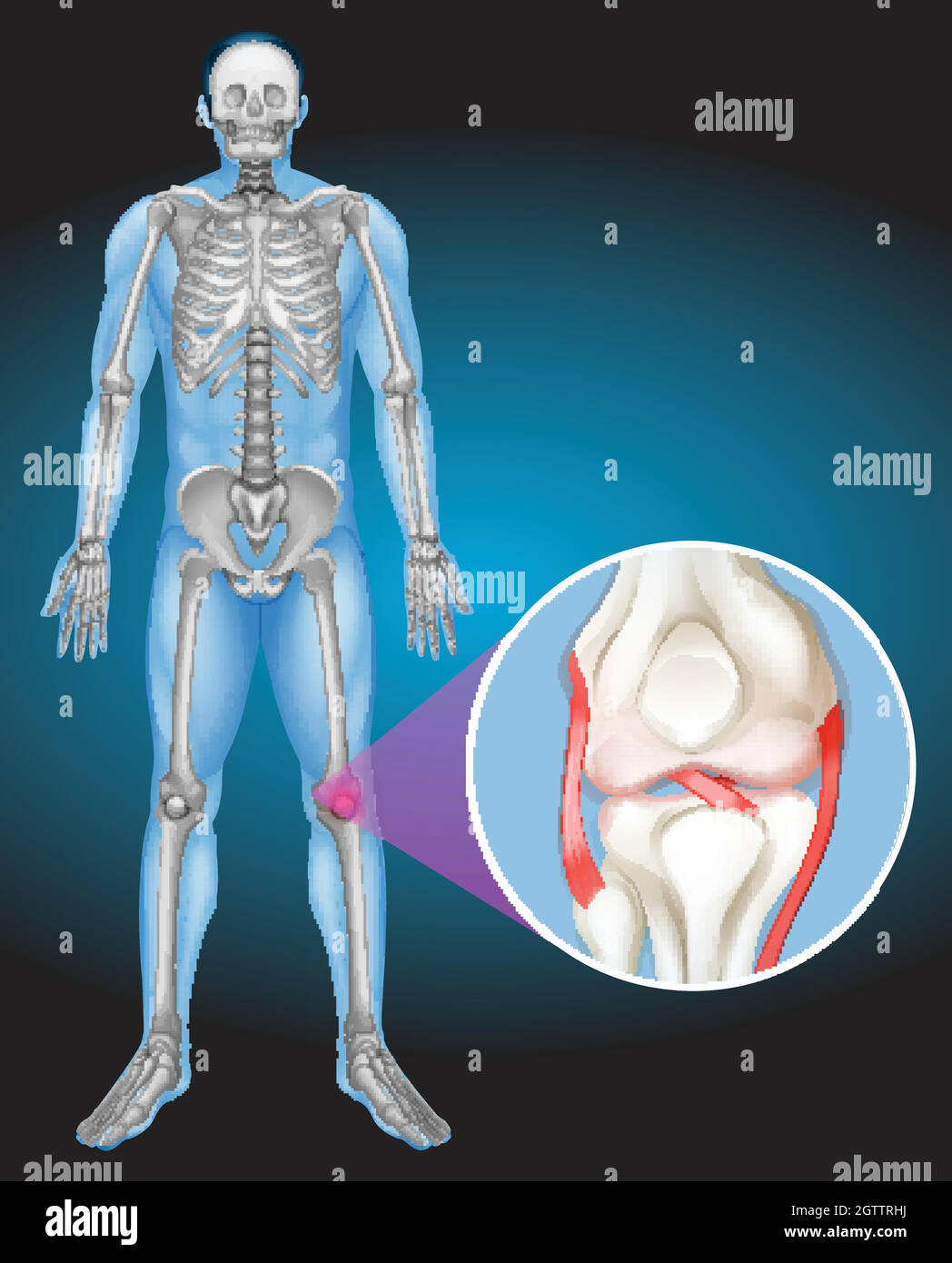Knie bänder Stock-Vektorgrafiken kaufen - Alamy