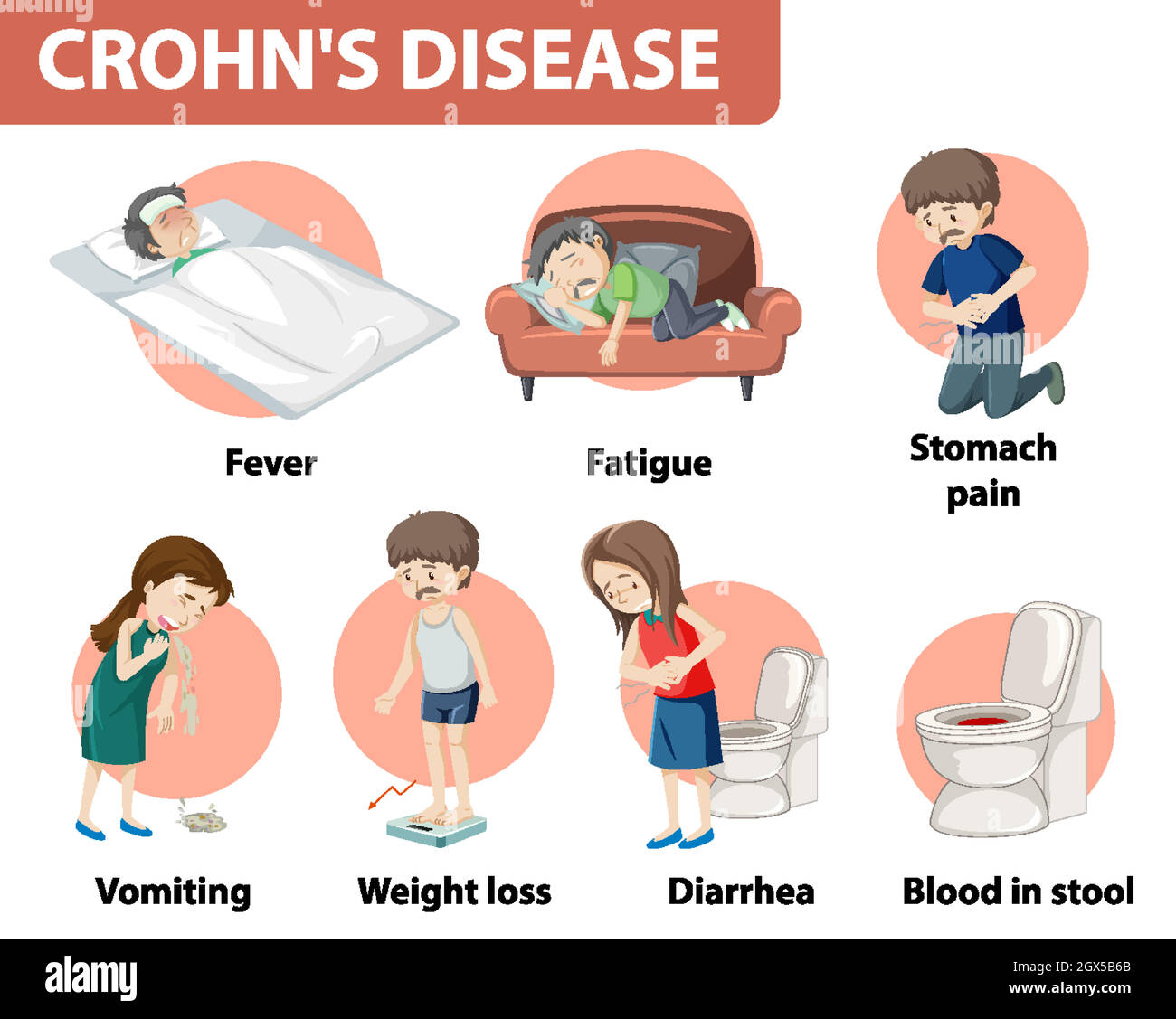 Medizinische Infografik der Morbus Crohn Stock-Vektorgrafik - Alamy