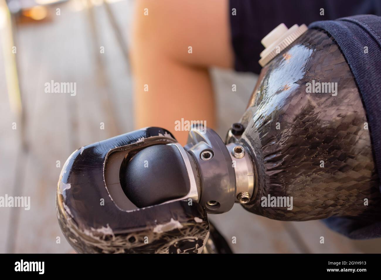 Neue Aluminium-Prothesen Beine für amputierte Patienten Stockfotografie ...