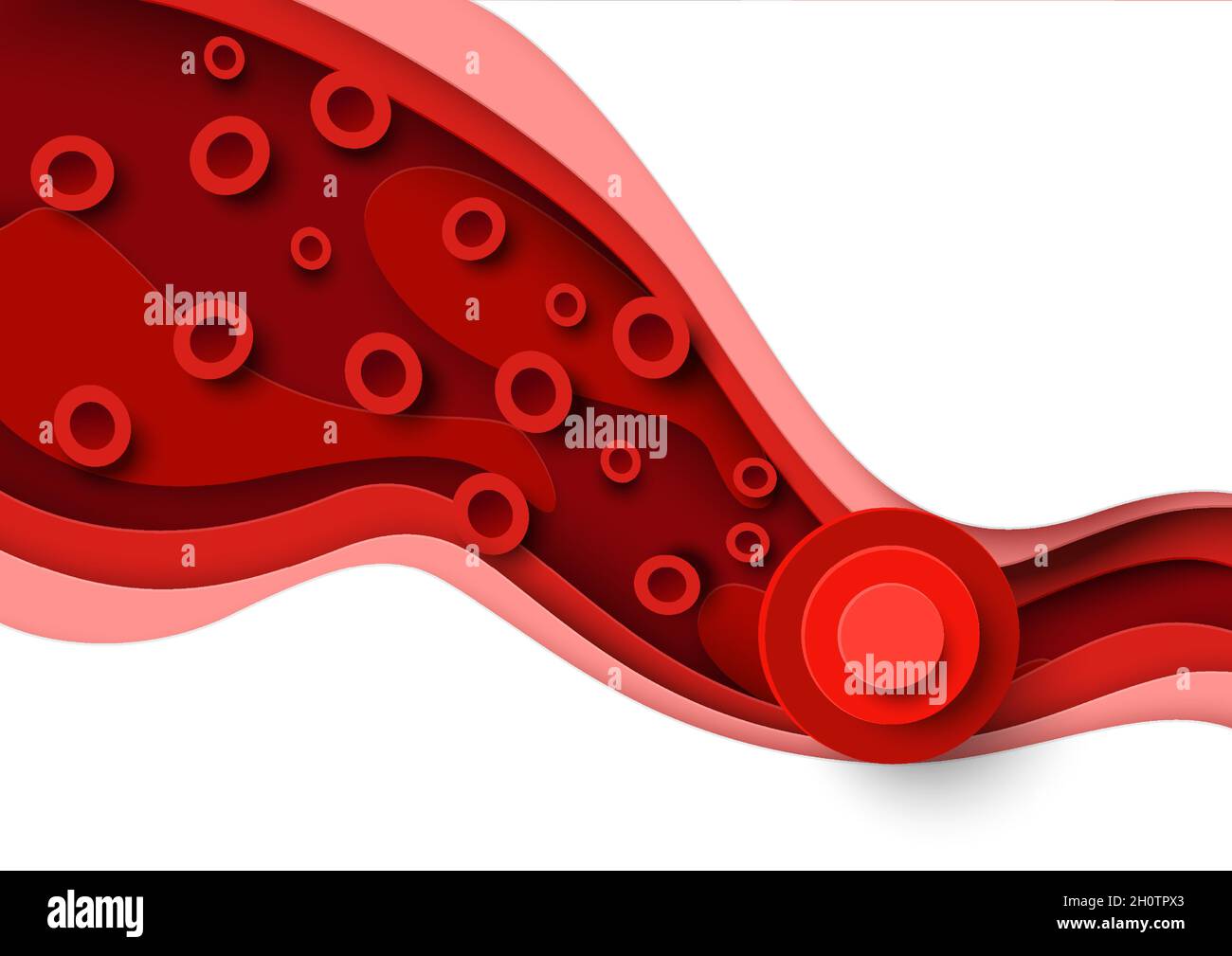 Blutgerinnsel, Thrombus in der Vene, Arterie, Vektorpapier Schnitt ...