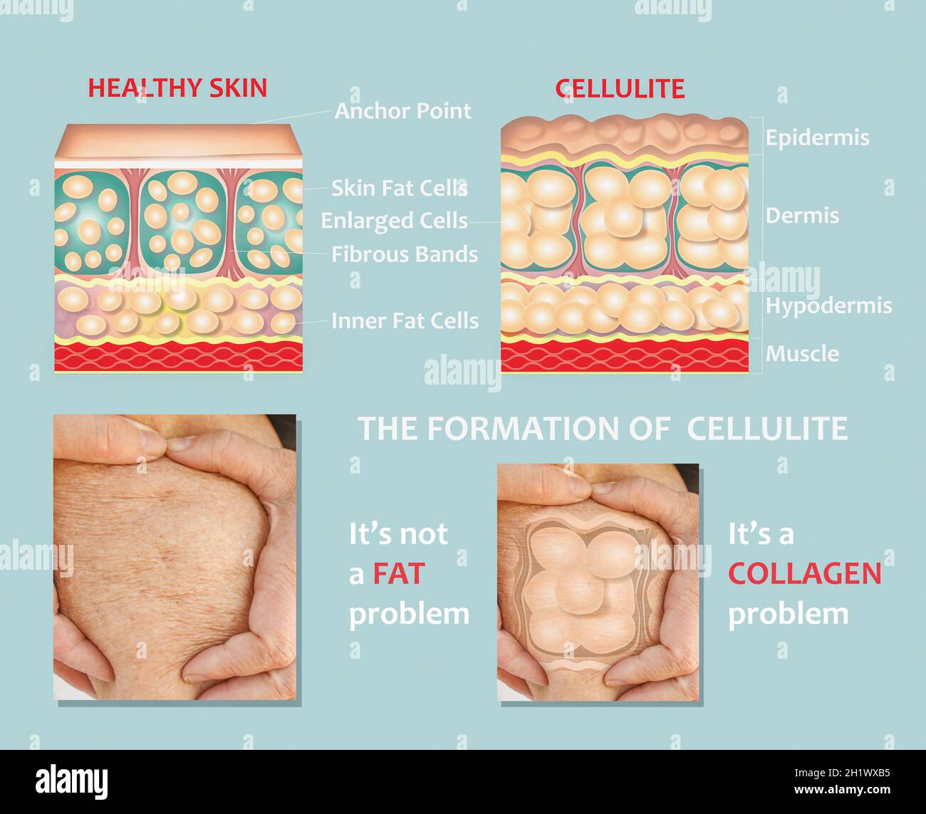 Haut schema -Fotos und -Bildmaterial in hoher Auflösung – Alamy