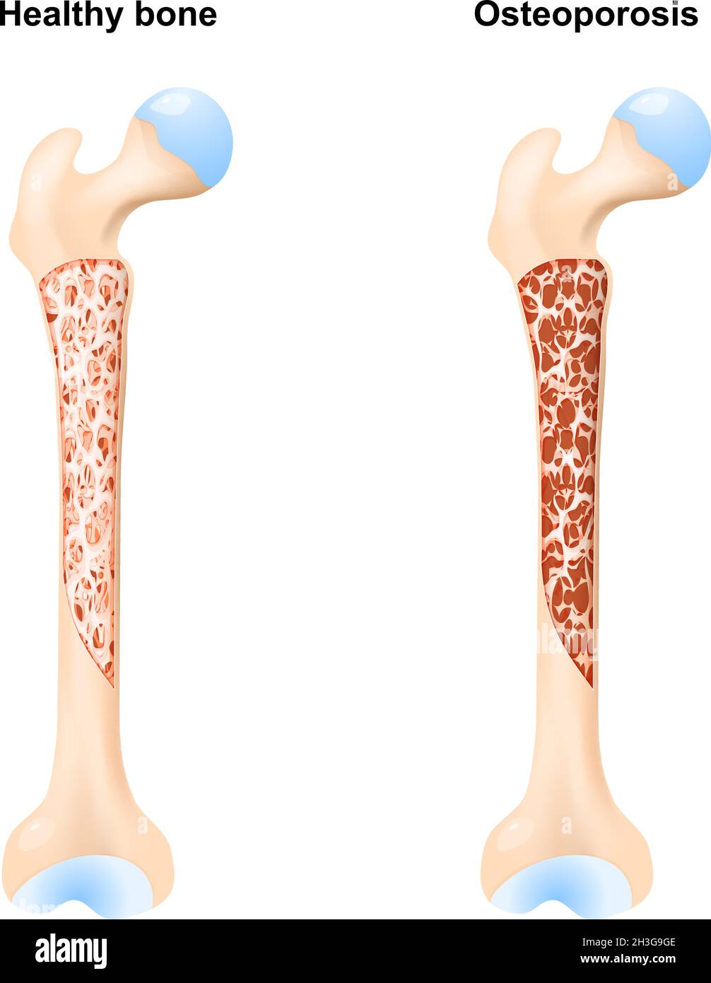 Querschnitt femur Stock-Vektorgrafiken kaufen - Alamy