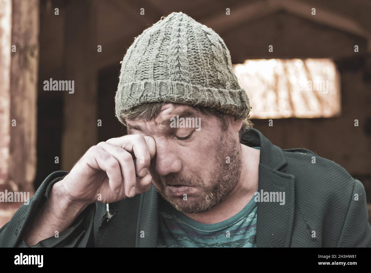 Faszinierend Alkoholiker Gesicht Bilder Bild