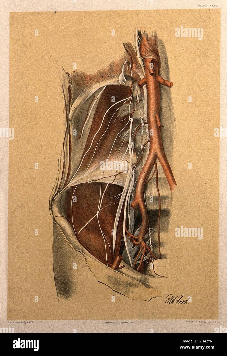 Dissektion des Unterleibs eines Mannes, zeigt die Arterien, Blutgefäße ...