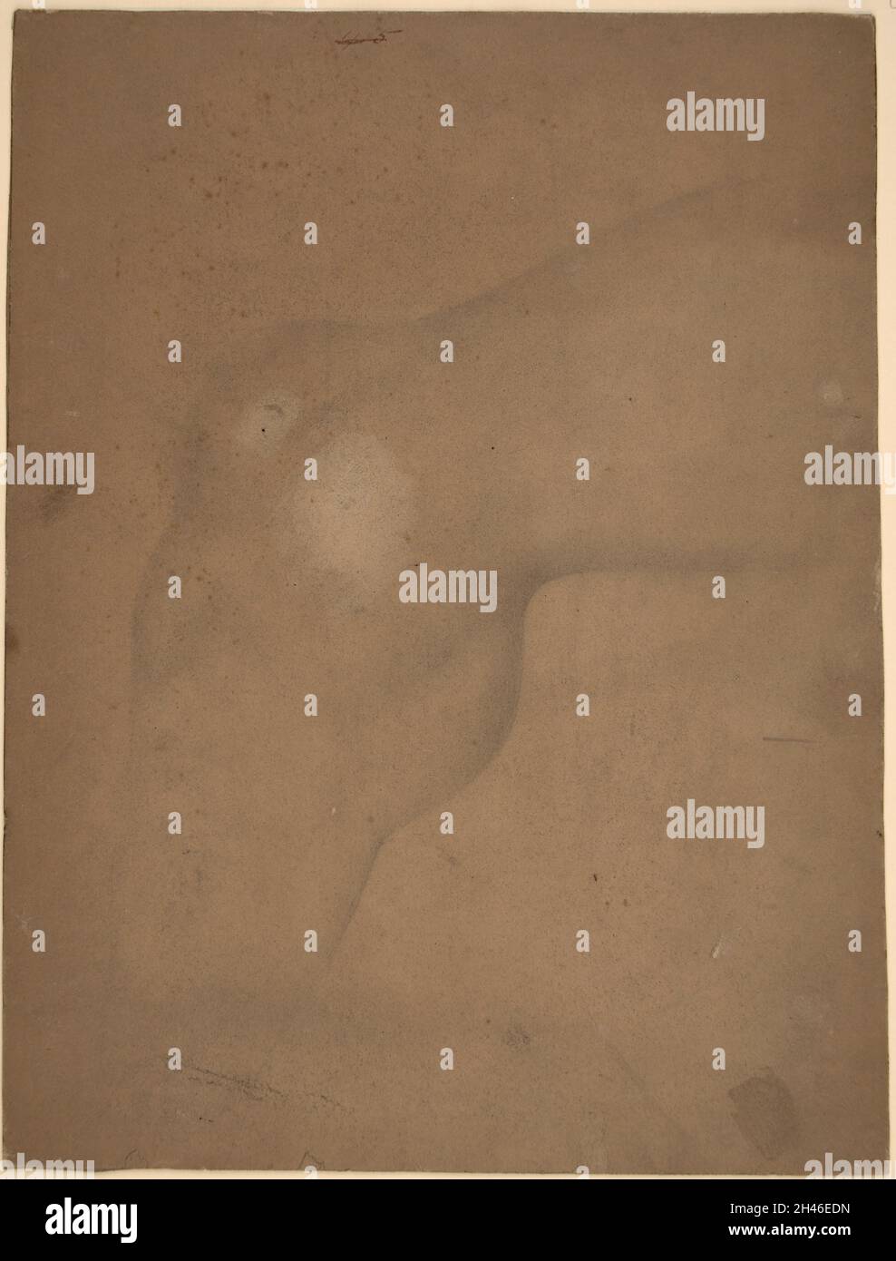 Popliteale zyste -Fotos und -Bildmaterial in hoher Auflösung – Alamy