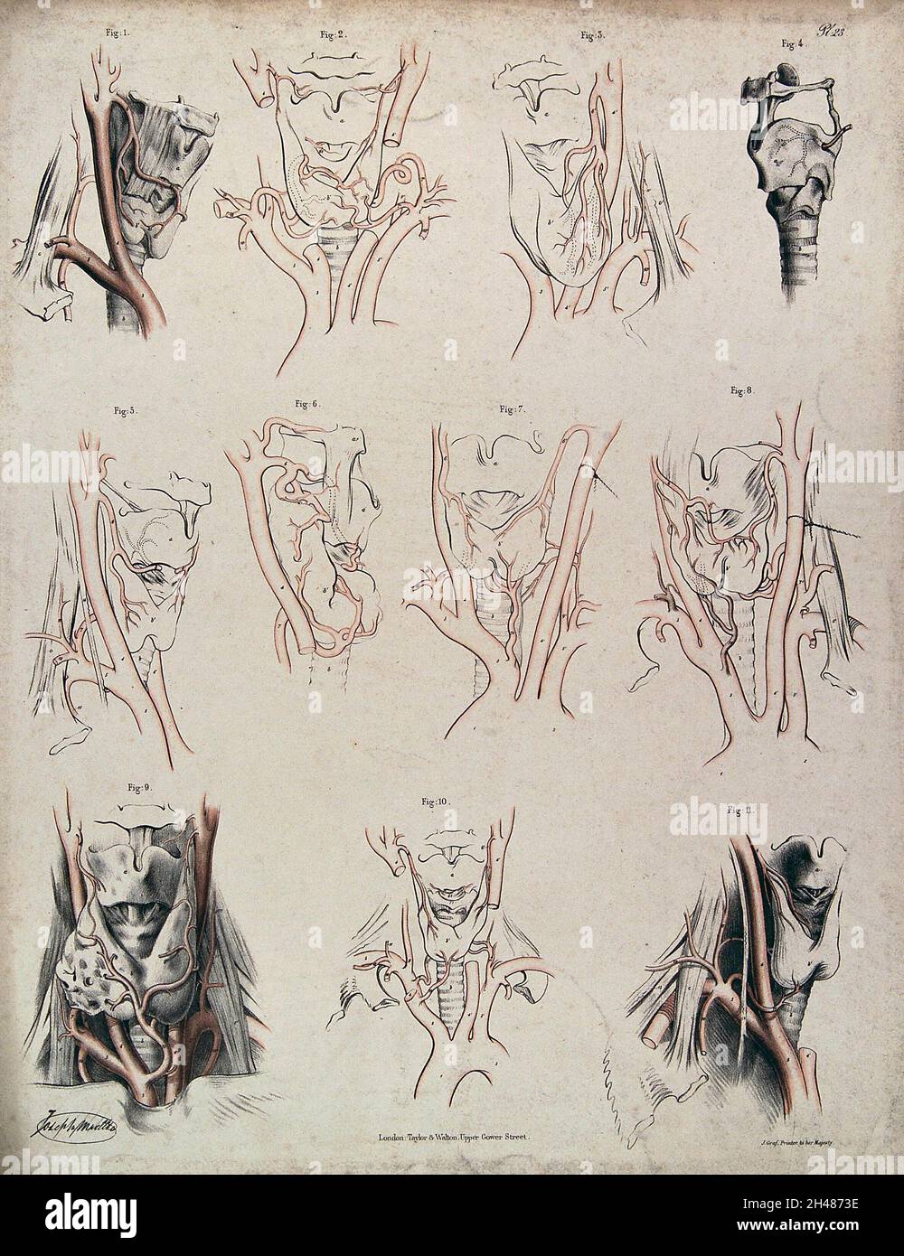 Organe im hals -Fotos und -Bildmaterial in hoher Auflösung – Alamy