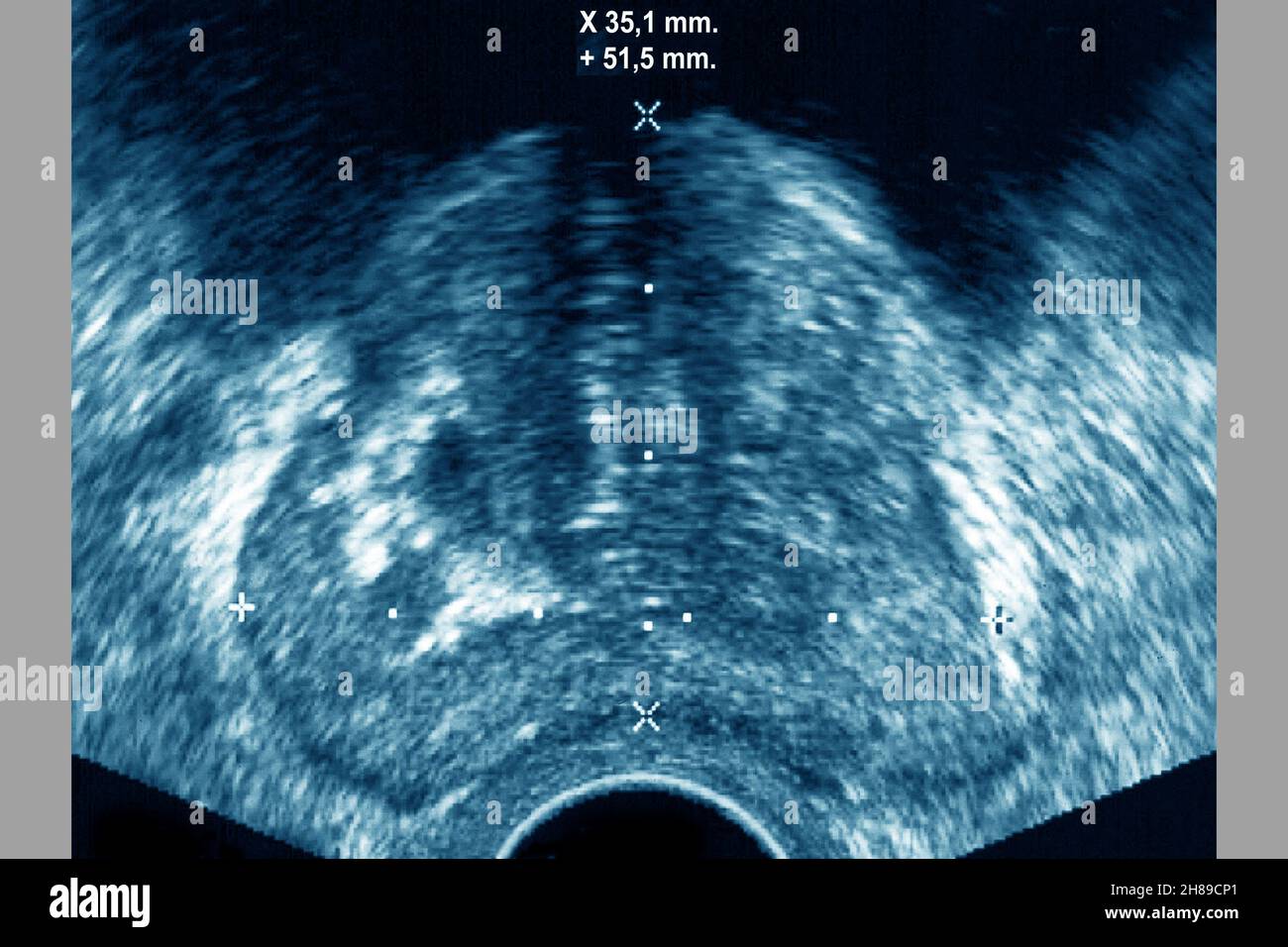 Prostate anatomy -Fotos und -Bildmaterial in hoher Auflösung – Alamy