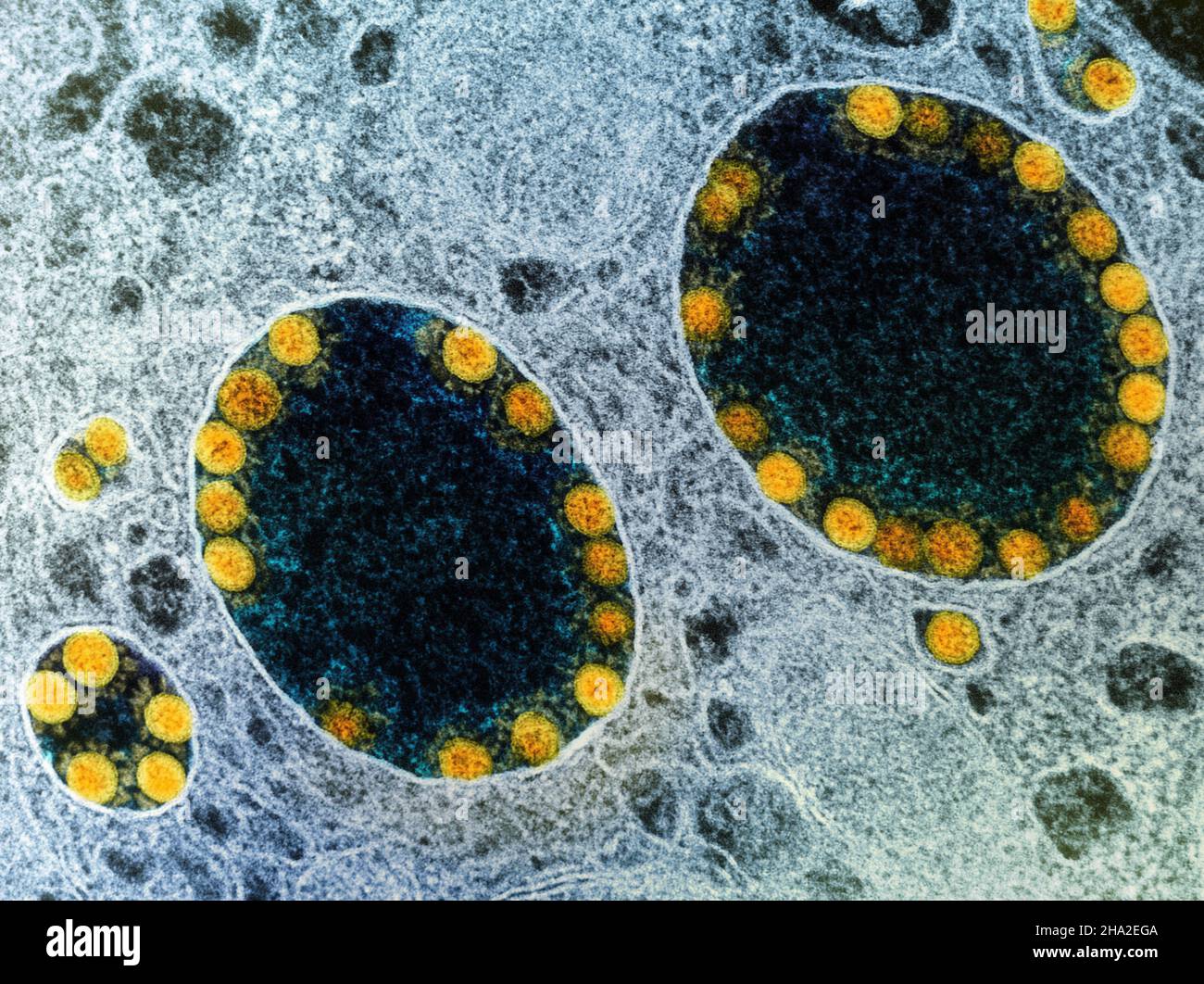 Olfaktorisches epithel -Fotos und -Bildmaterial in hoher Auflösung – Alamy