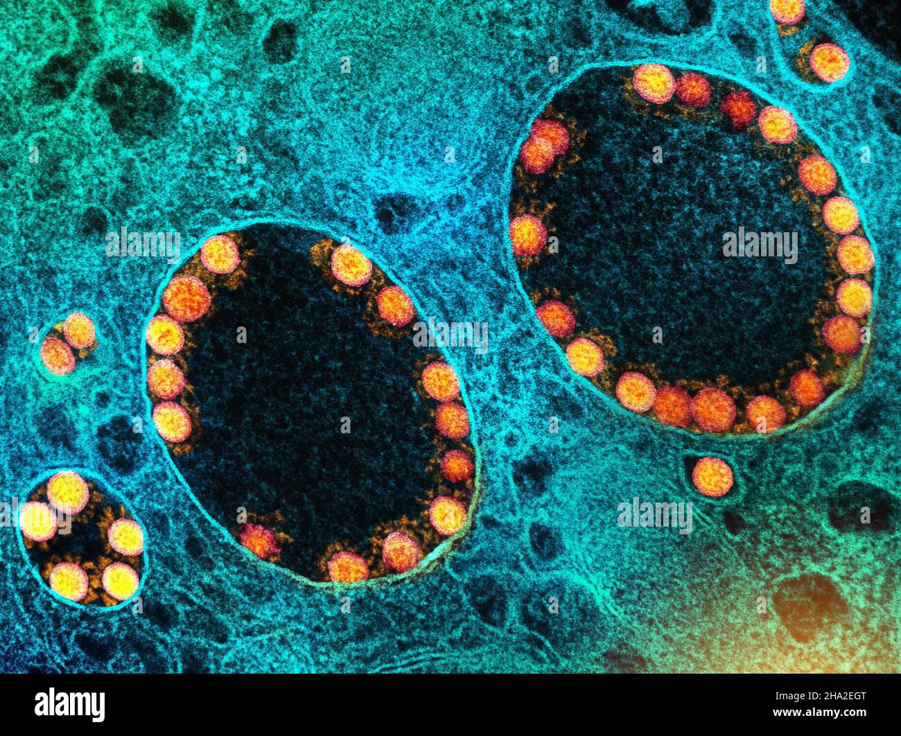 Olfaktorisches epithel -Fotos und -Bildmaterial in hoher Auflösung – Alamy