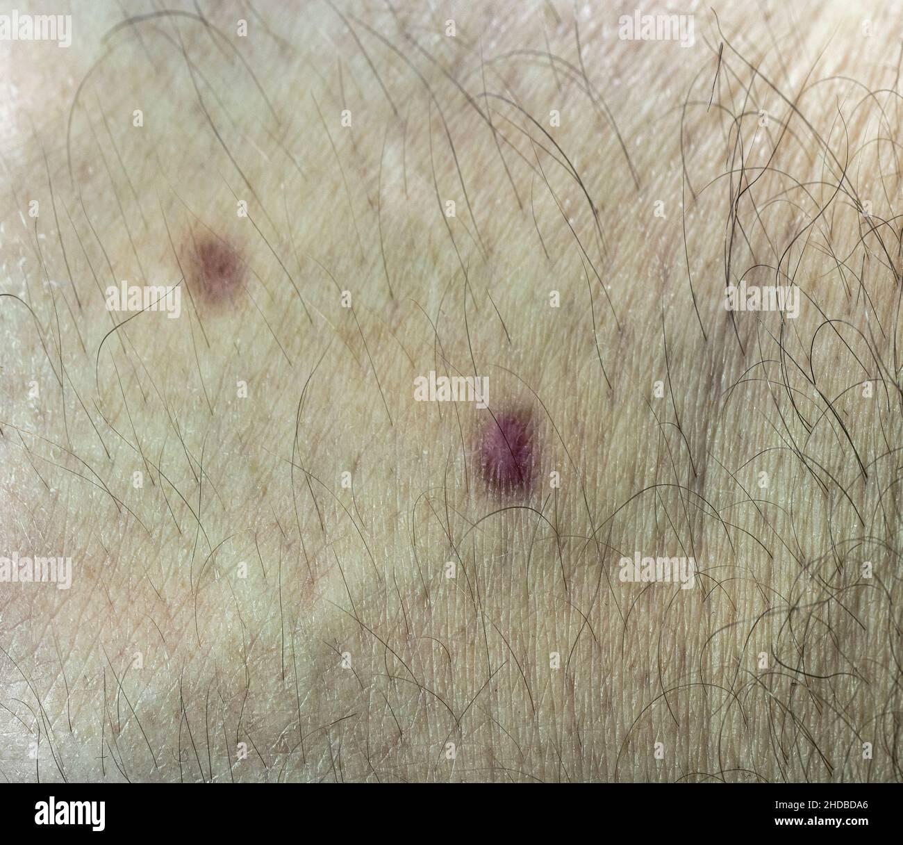 Histology human skin -Fotos und -Bildmaterial in hoher Auflösung – Alamy