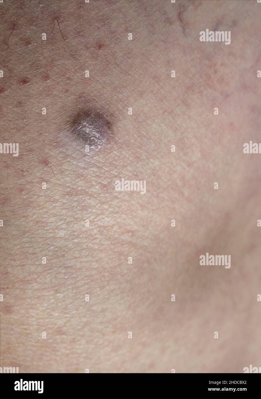 Histology human skin -Fotos und -Bildmaterial in hoher Auflösung – Alamy