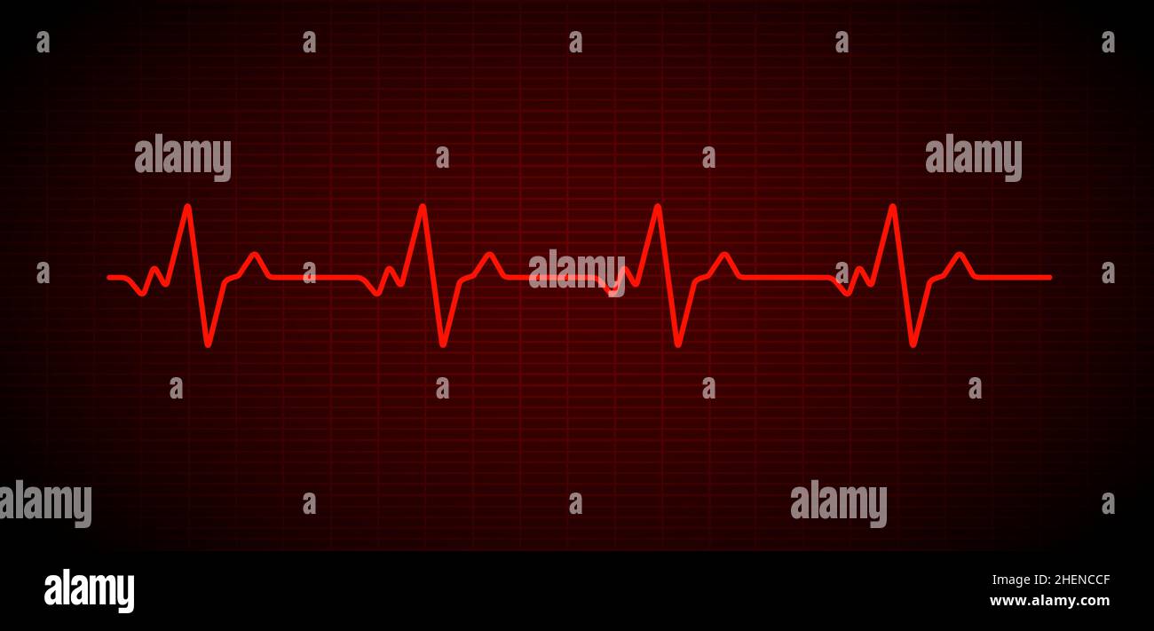 Herzschlag ekg Elektrokardiogramm Vektorgrafik Kurvenlinie. EKG ...