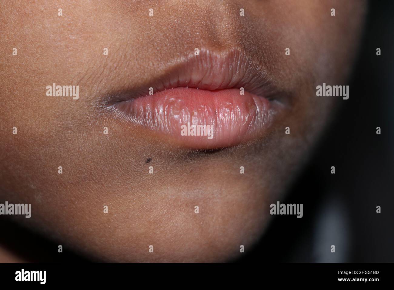 Falsche lippen -Fotos und -Bildmaterial in hoher Auflösung – Alamy