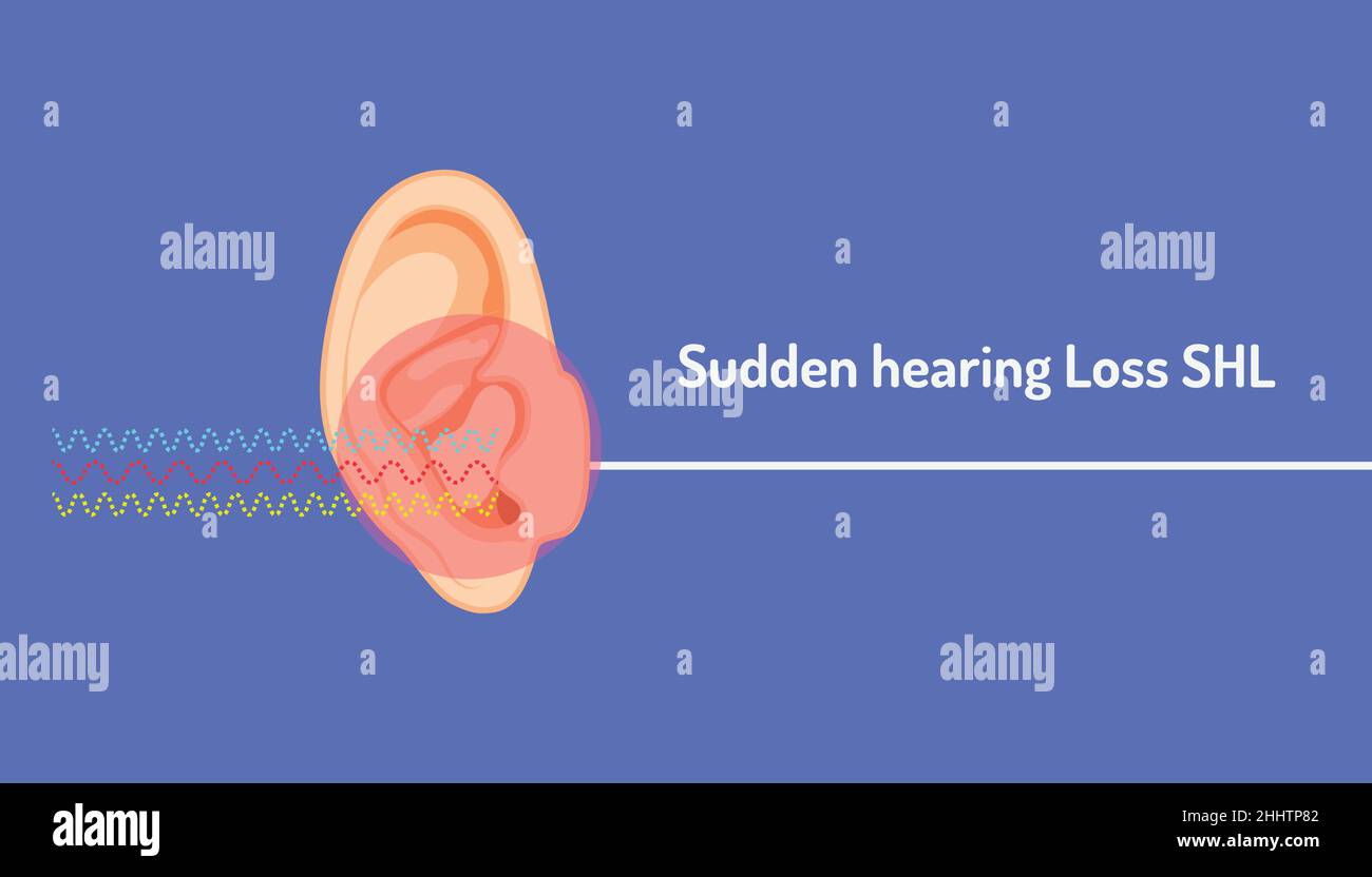Shl symbol -Fotos und -Bildmaterial in hoher Auflösung – Alamy