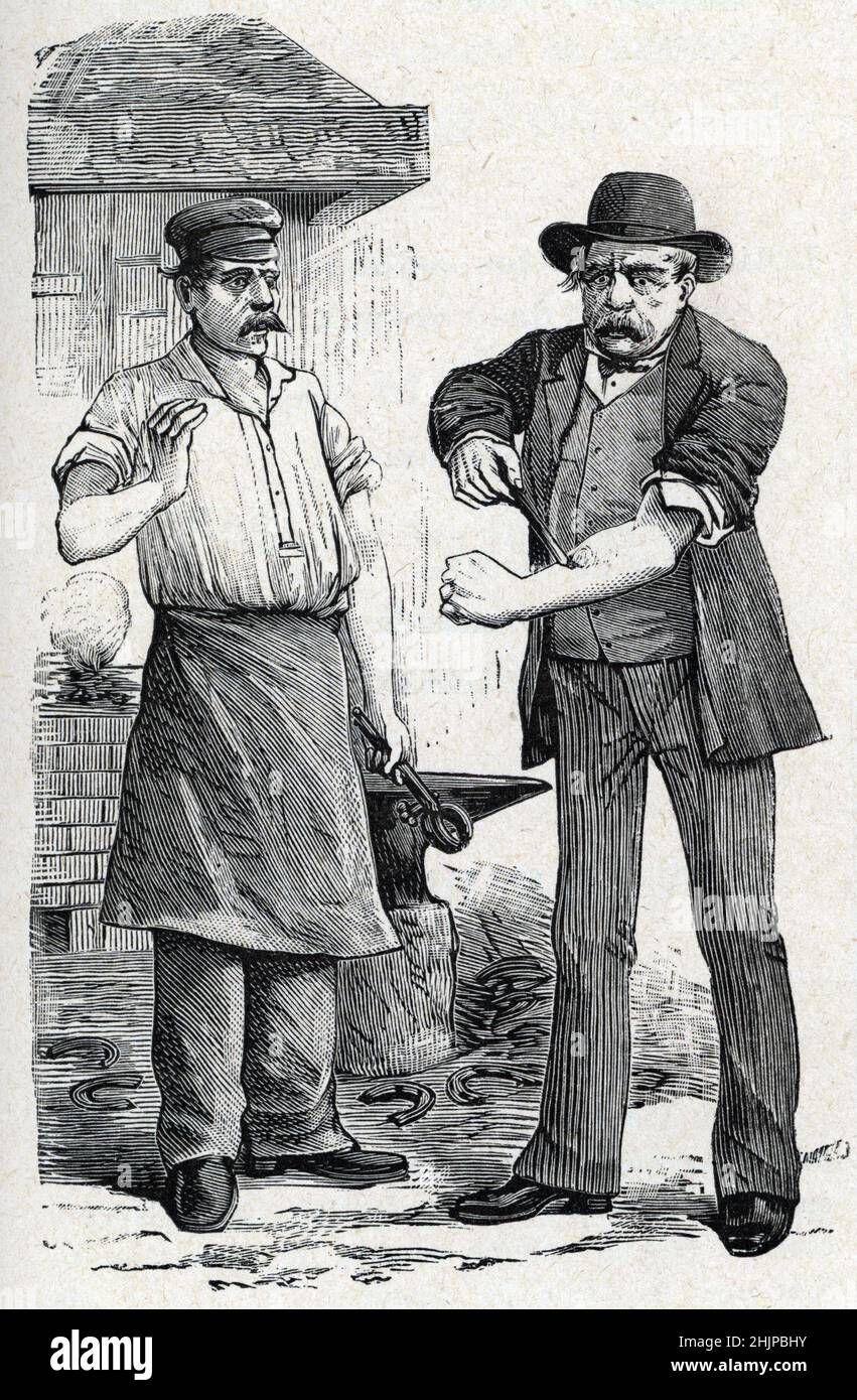 Repräsentation d'une cauterization au fer Rouge pour refermer une plaie ...