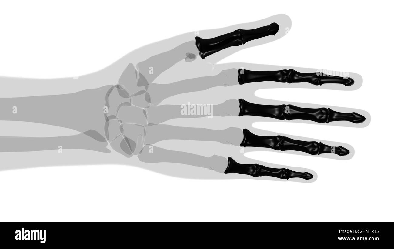 Menschliche Skelett Hand Phalanges Knochen Anatomie für medizinisches ...