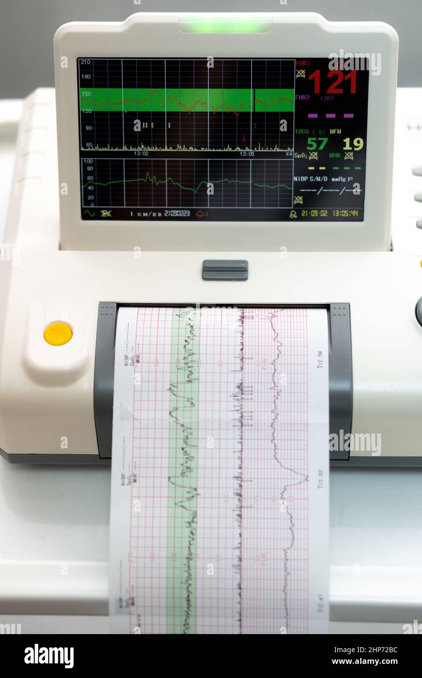 Kardiotokographie kardiotokographie untersuchung -Fotos und ...