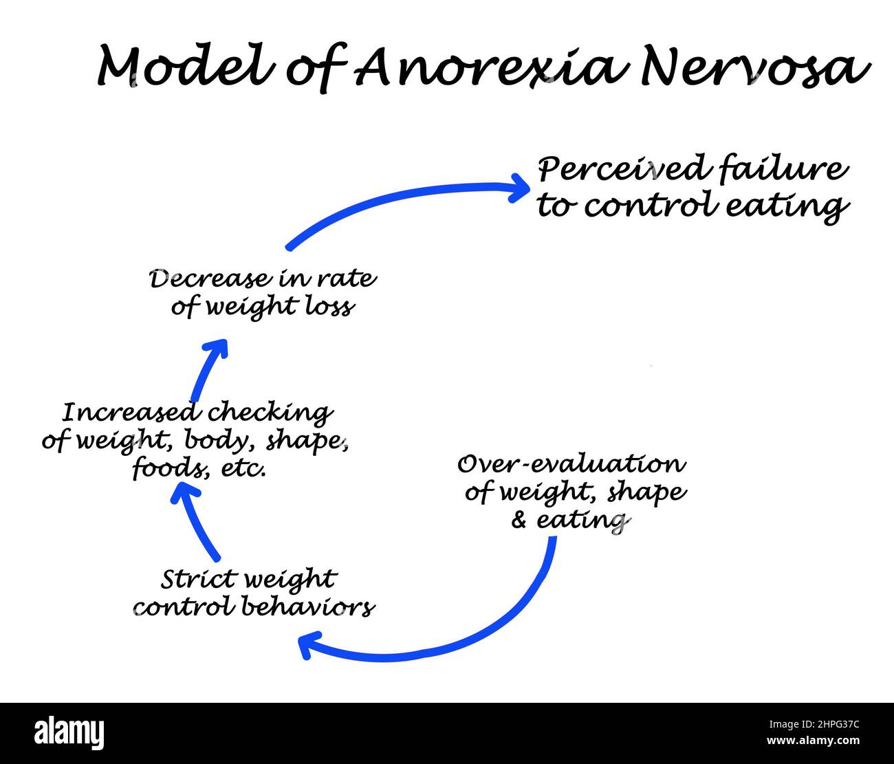 Anorexia nervosa -Fotos und -Bildmaterial in hoher Auflösung – Alamy