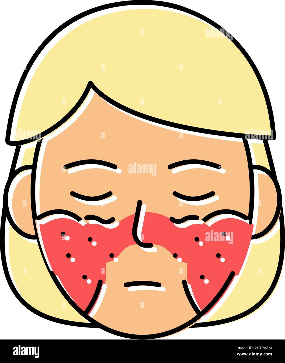 Systemischer Lupus erythematodes Farbe Symbol Vektor Illustration Stock ...