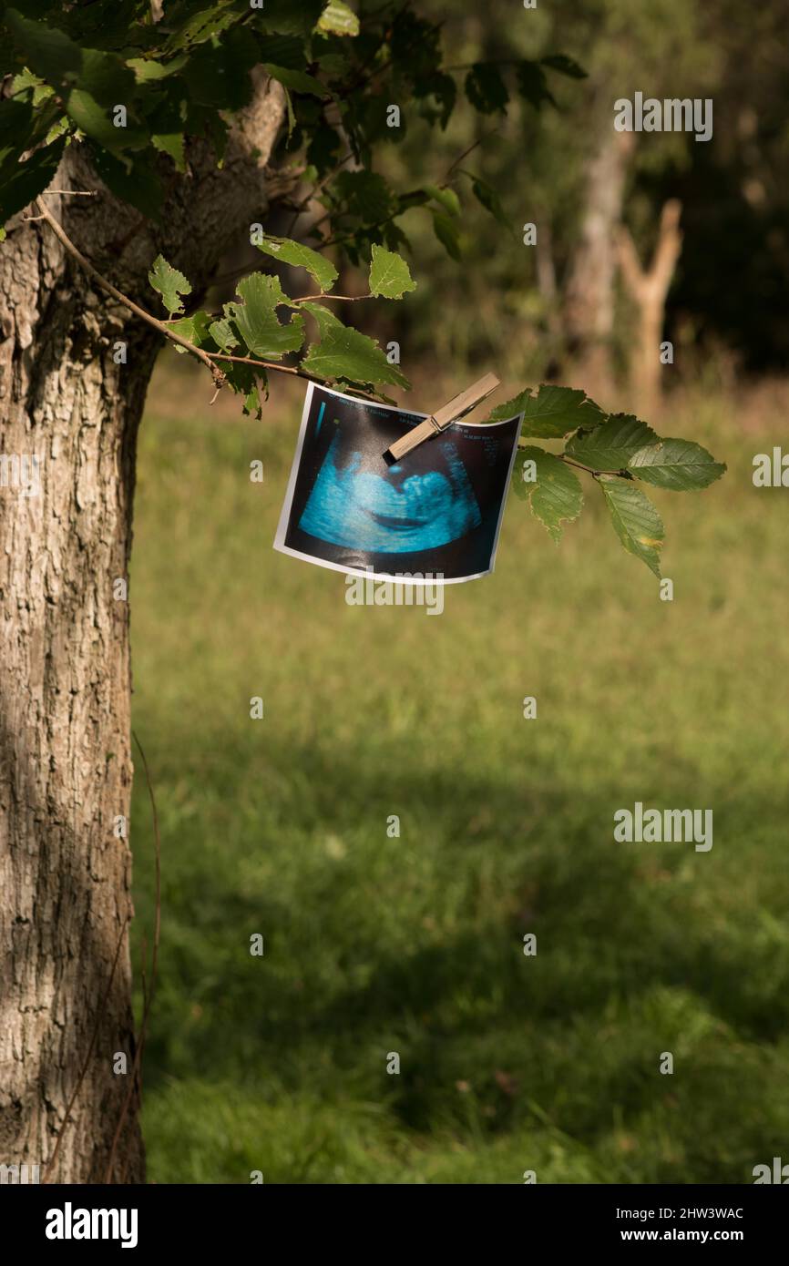 Ultraschallbild embryo -Fotos und -Bildmaterial in hoher Auflösung – Alamy