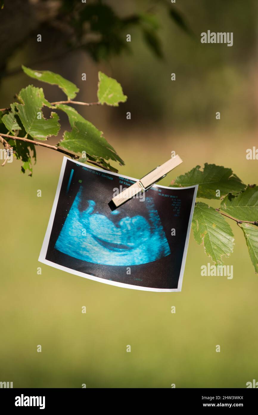 Ultraschallbild embryo -Fotos und -Bildmaterial in hoher Auflösung – Alamy