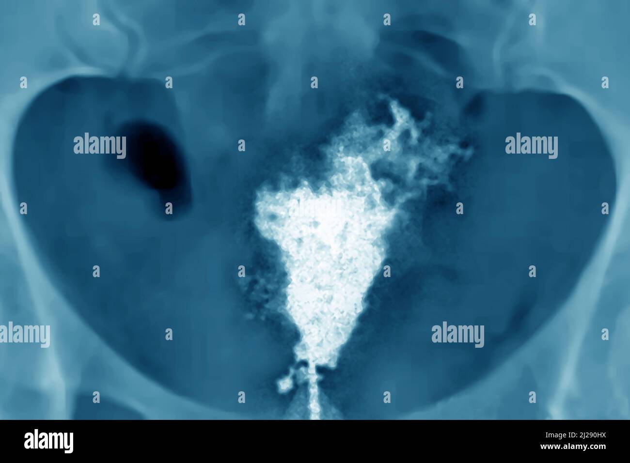 Human uterus -Fotos und -Bildmaterial in hoher Auflösung – Alamy