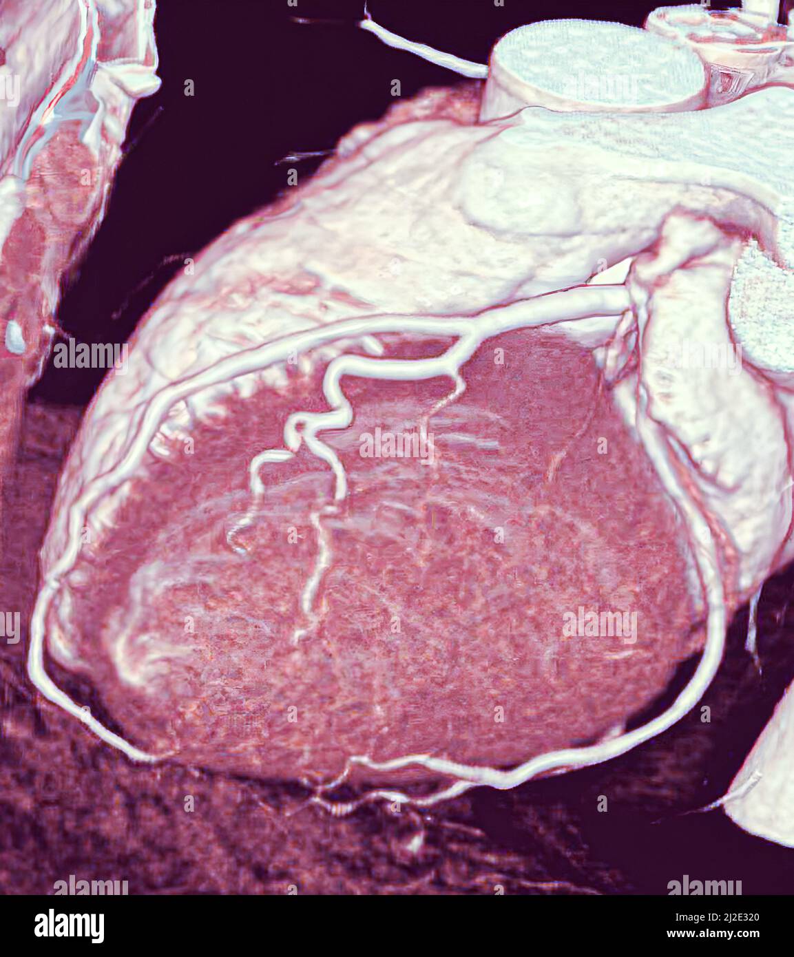 3d ct scan human heart -Fotos und -Bildmaterial in hoher Auflösung – Alamy