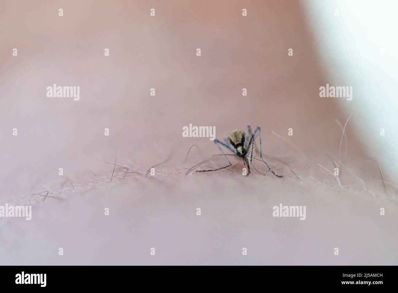 Leishmaniose mensch -Fotos und -Bildmaterial in hoher Auflösung – Alamy