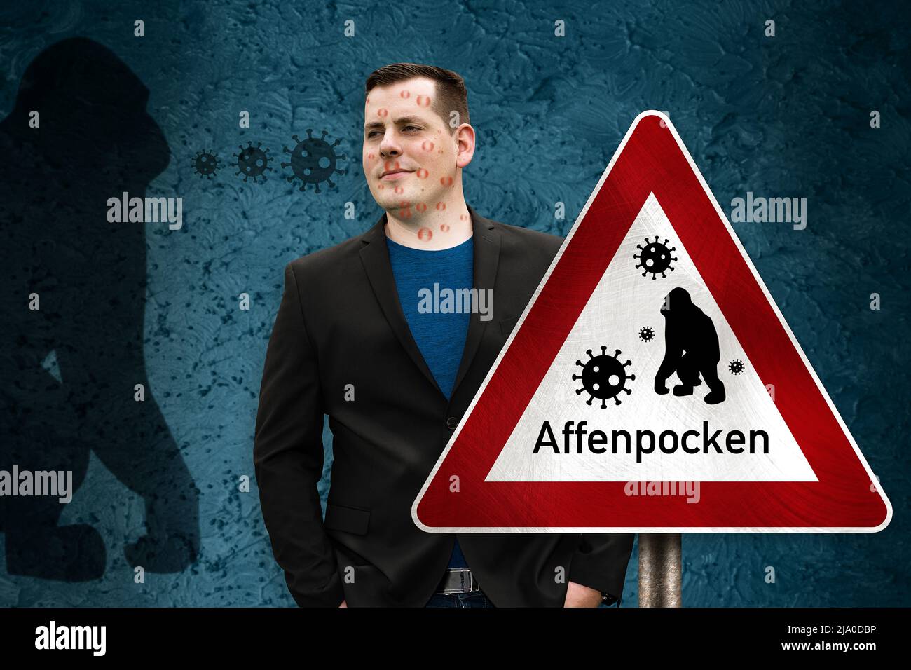 Orthopoxvirus variola -Fotos und -Bildmaterial in hoher Auflösung – Alamy