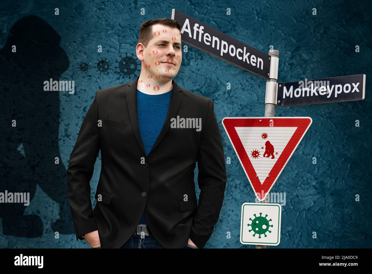 Orthopoxvirus variola -Fotos und -Bildmaterial in hoher Auflösung – Alamy