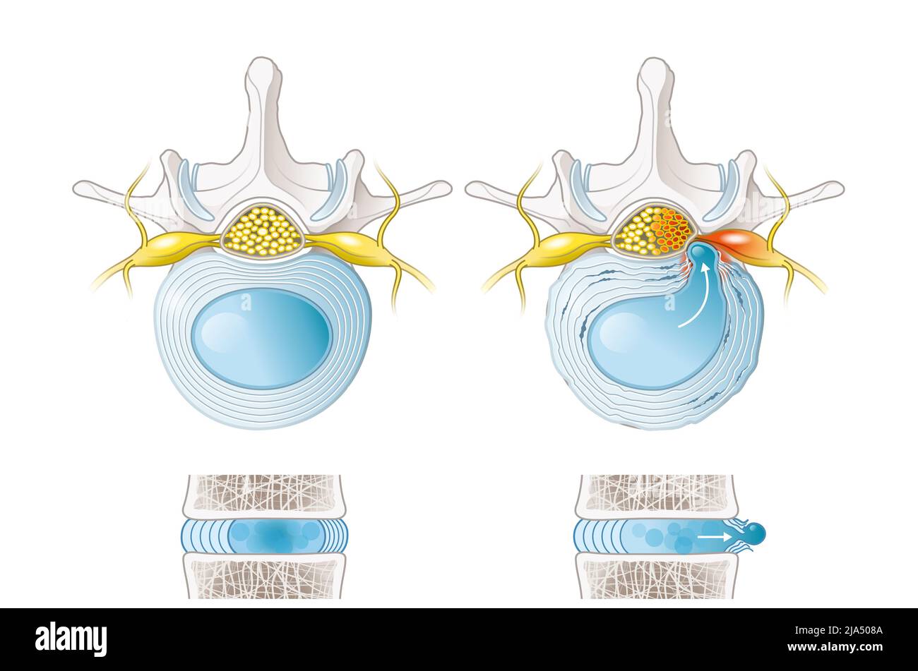 Normal anatomy of lumbar spine -Fotos und -Bildmaterial in hoher ...