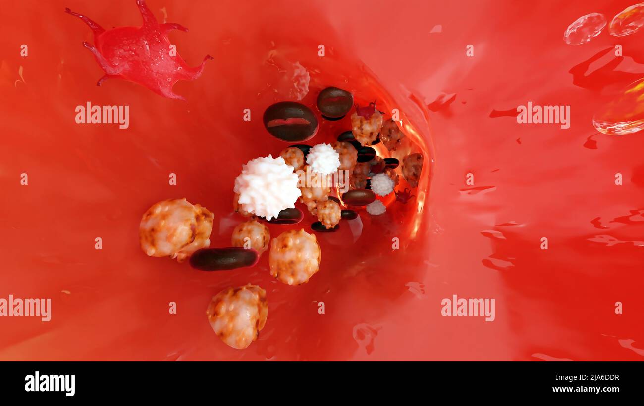 Pocken variante -Fotos und -Bildmaterial in hoher Auflösung – Alamy