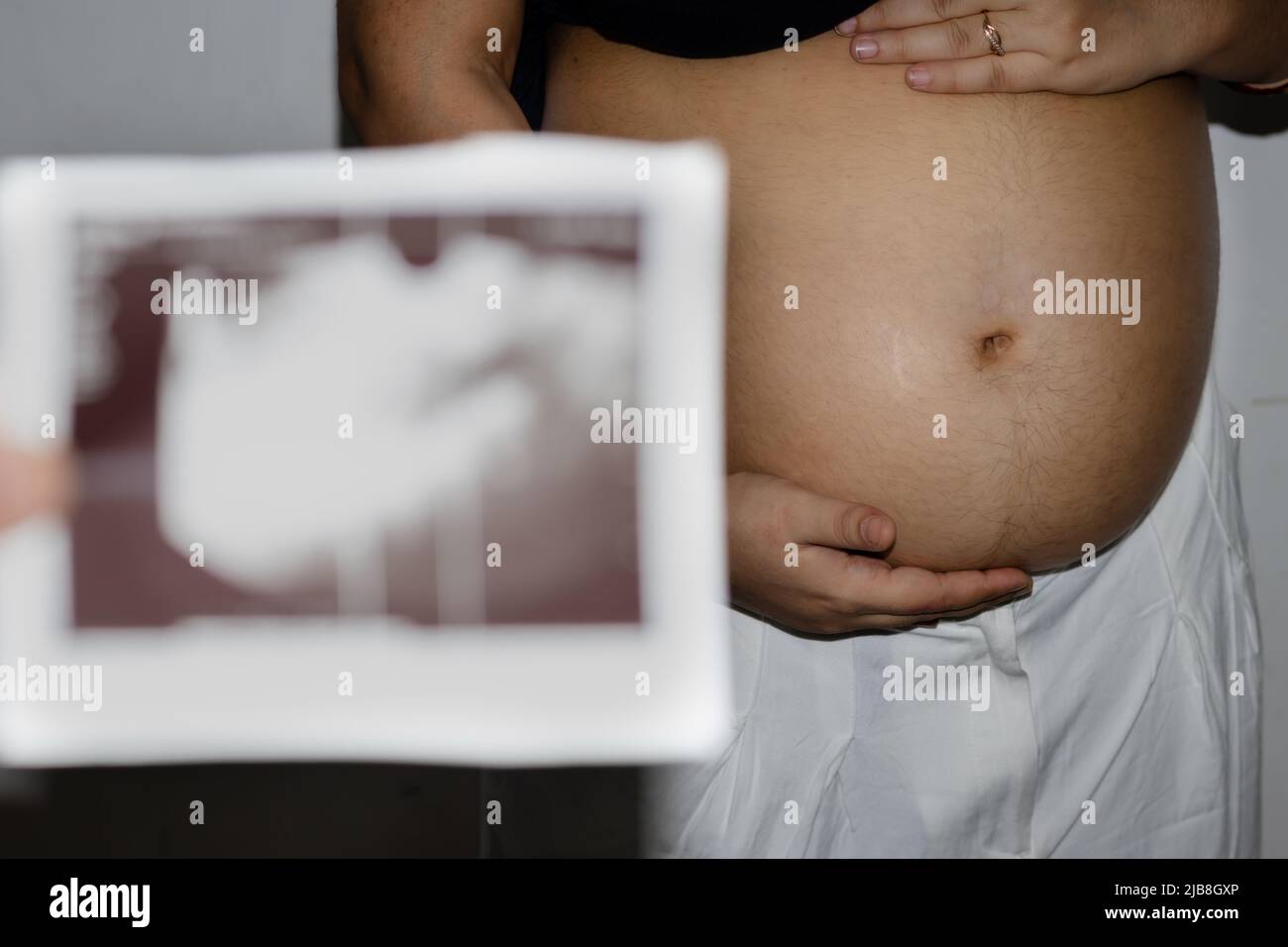 Junge Schwangere zeigen ihren runden Bauch mit verschwommenem Sonogramm ...