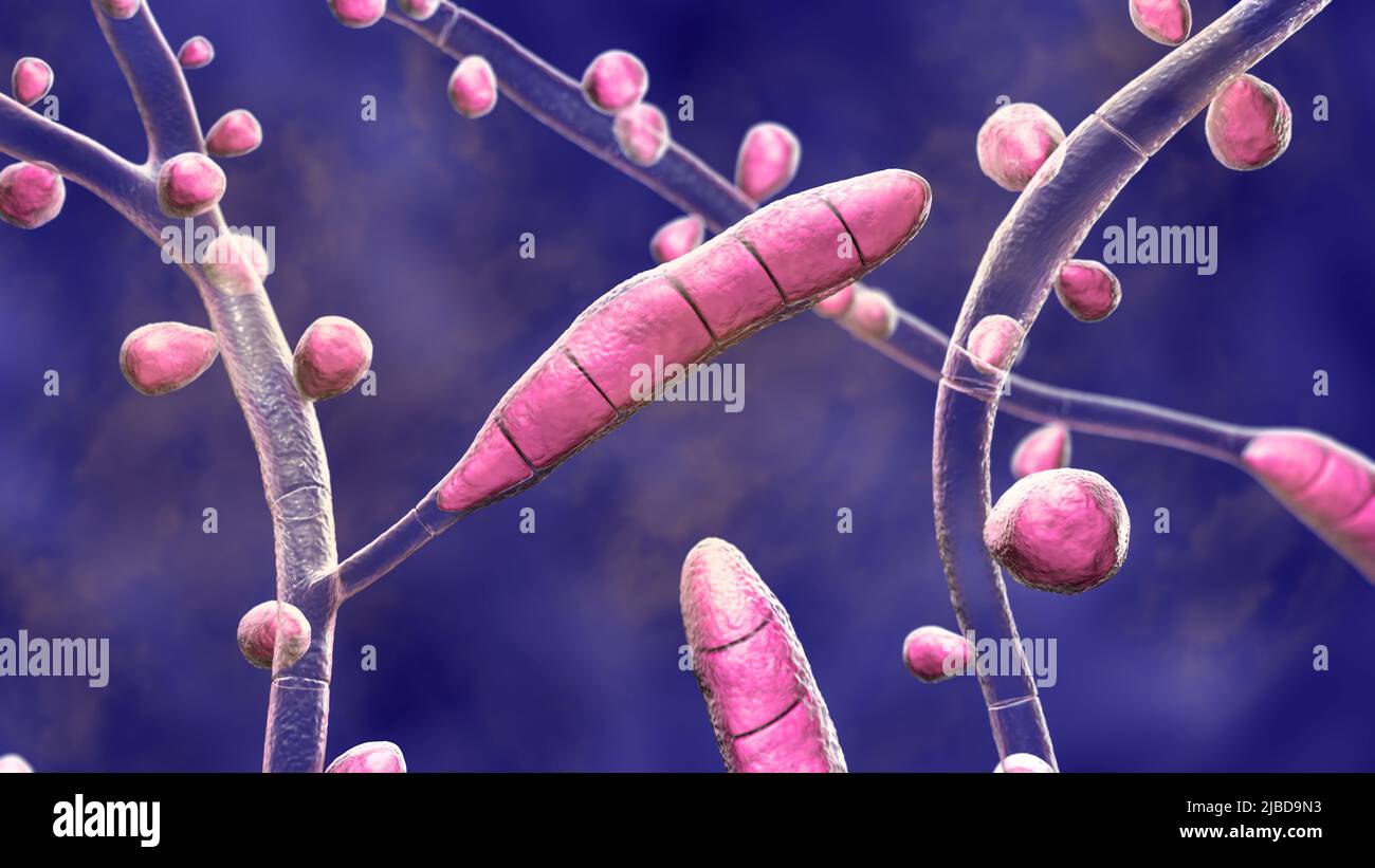 Hautinfektion mit dermatophyten Stockfotos und -bilder Kaufen - Alamy