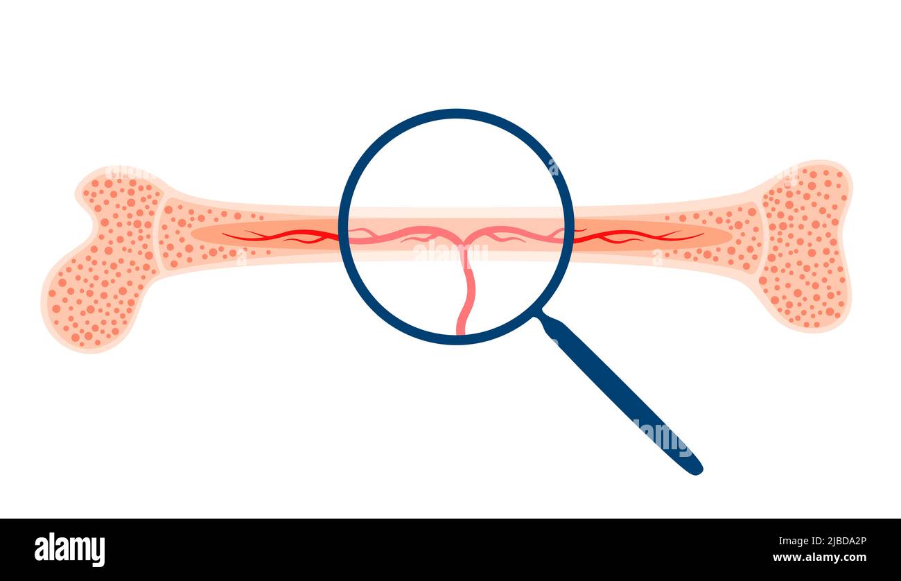 Knochenaufbau system -Fotos und -Bildmaterial in hoher Auflösung – Alamy
