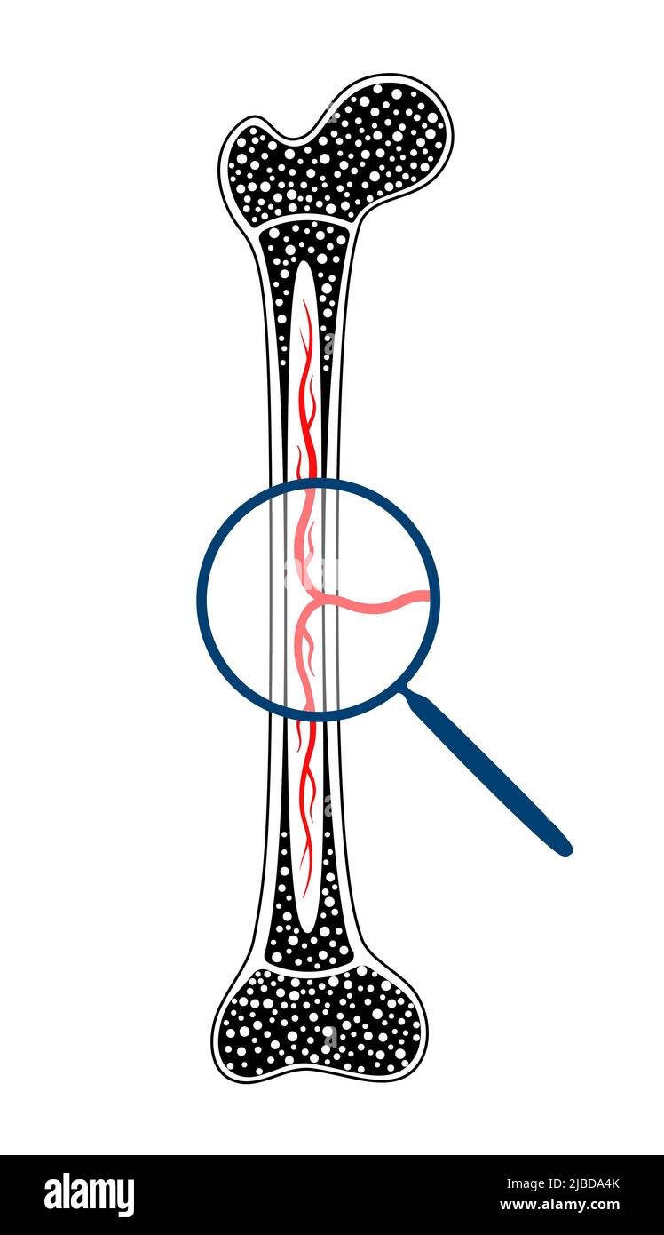 Knochenaufbau system -Fotos und -Bildmaterial in hoher Auflösung – Alamy