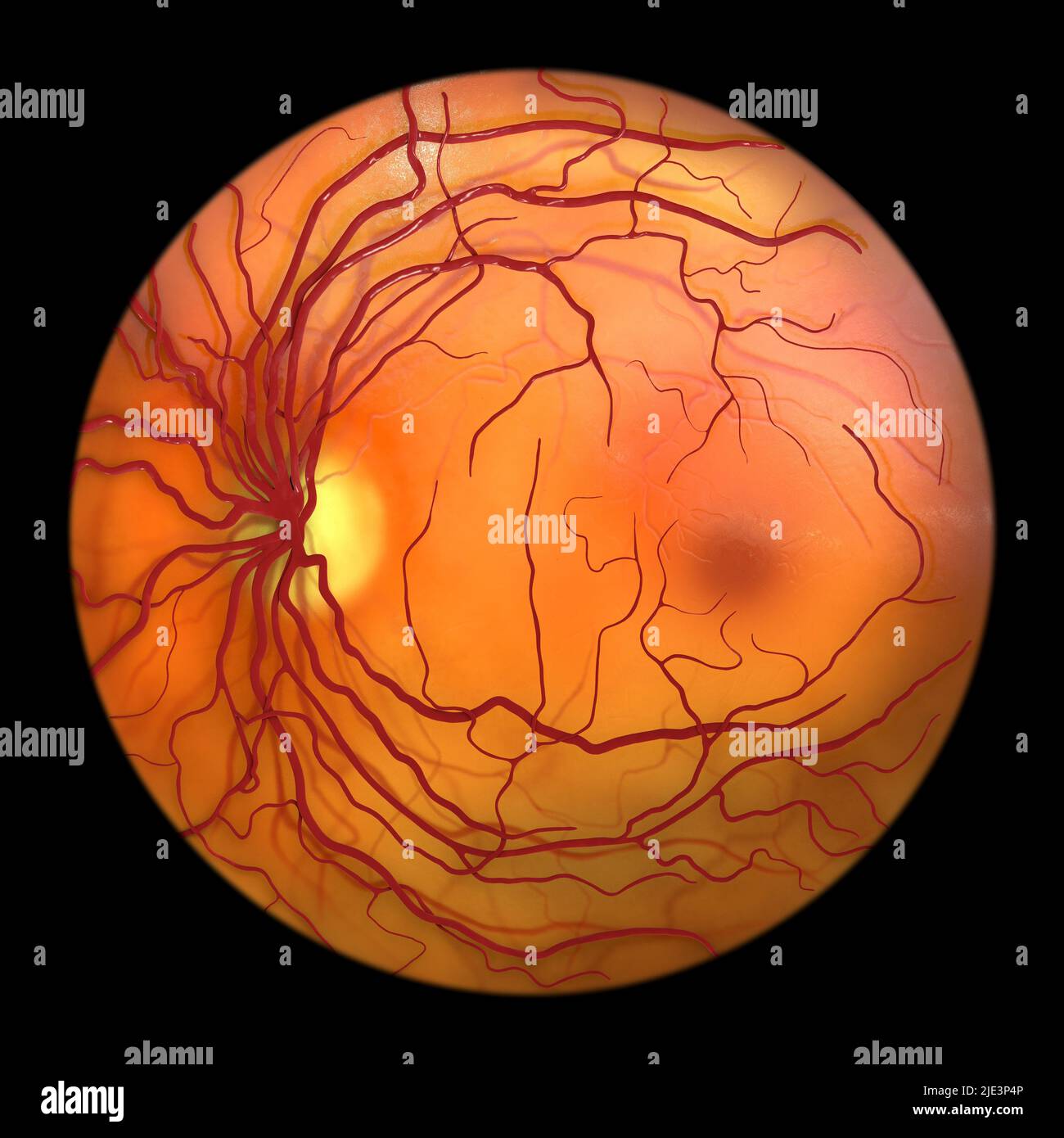 Normale Netzhaut, Ophthalmoskop-Bild, Illustration. Die Netzhaut ist ...
