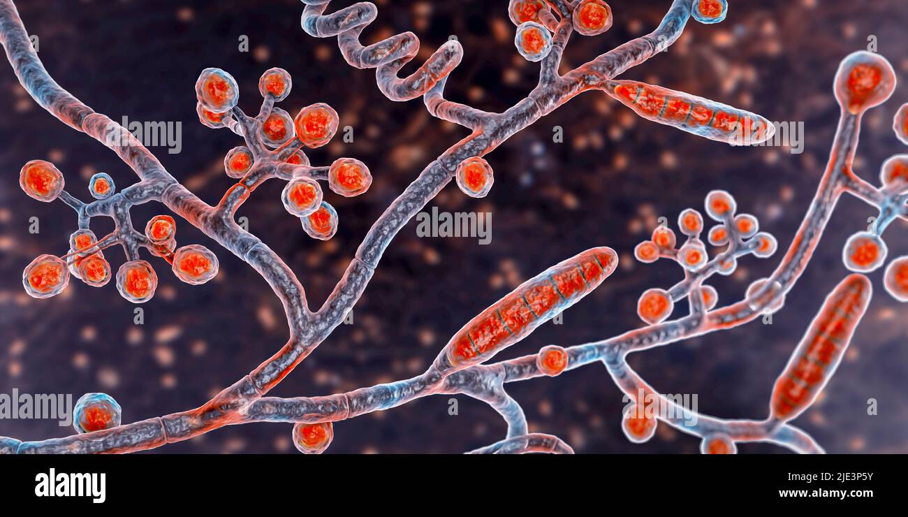 Pilze Trichophyton mentagrophytes, die Ursache für Fußpilz (Tinea pedis ...