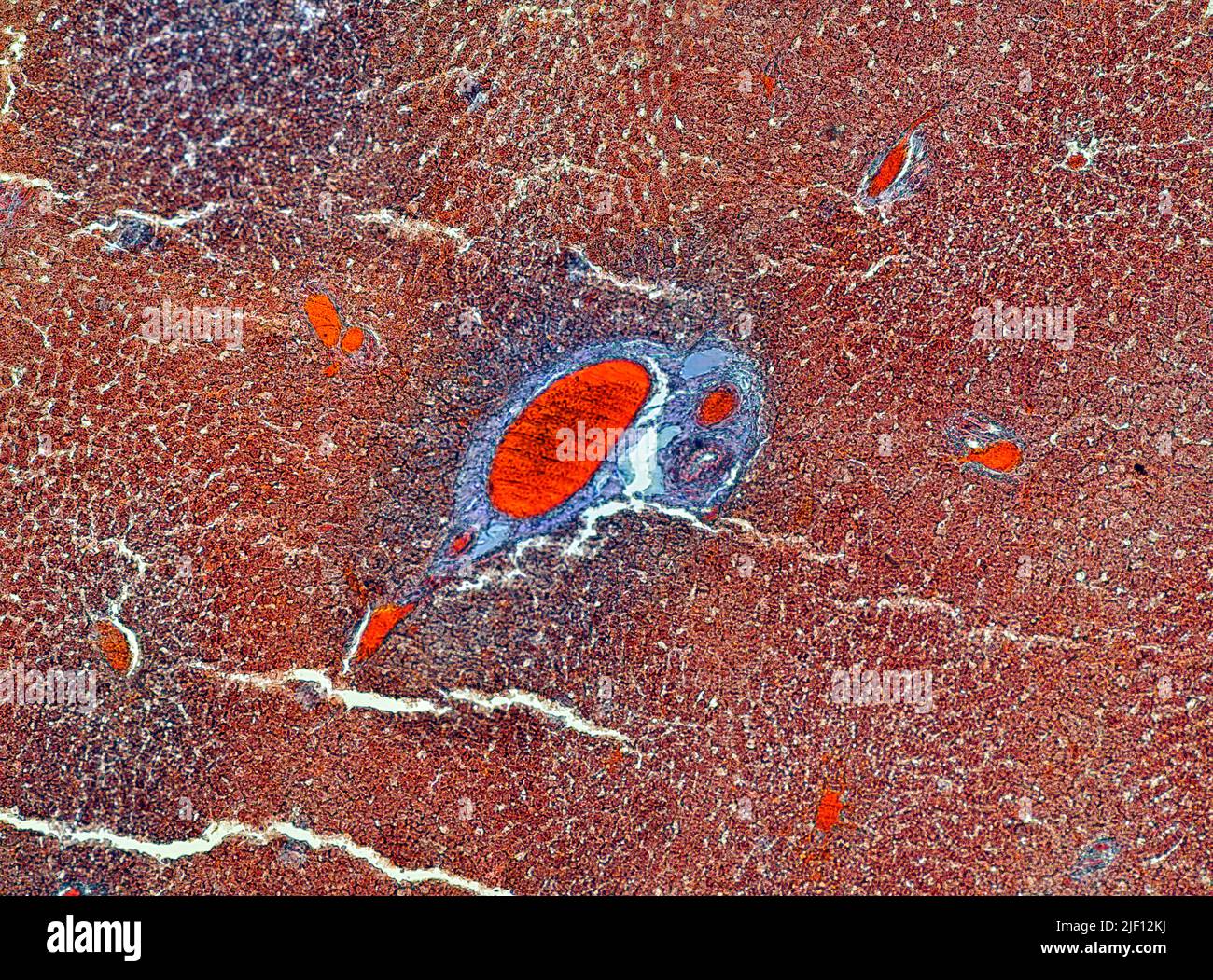 Glycogen liver cell -Fotos und -Bildmaterial in hoher Auflösung – Alamy