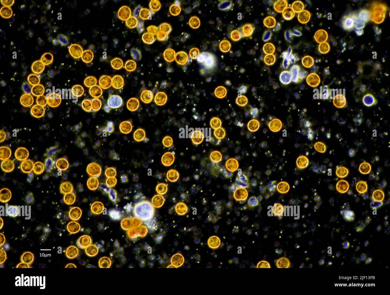 Mikroskopische Aufnahme von symbiotischen Algen (Zooxanthellae) der ...