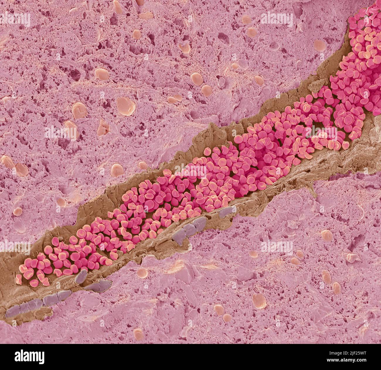 Lebervene. Farbiger Rasterelektronenmikrograph (SEM) einer ...