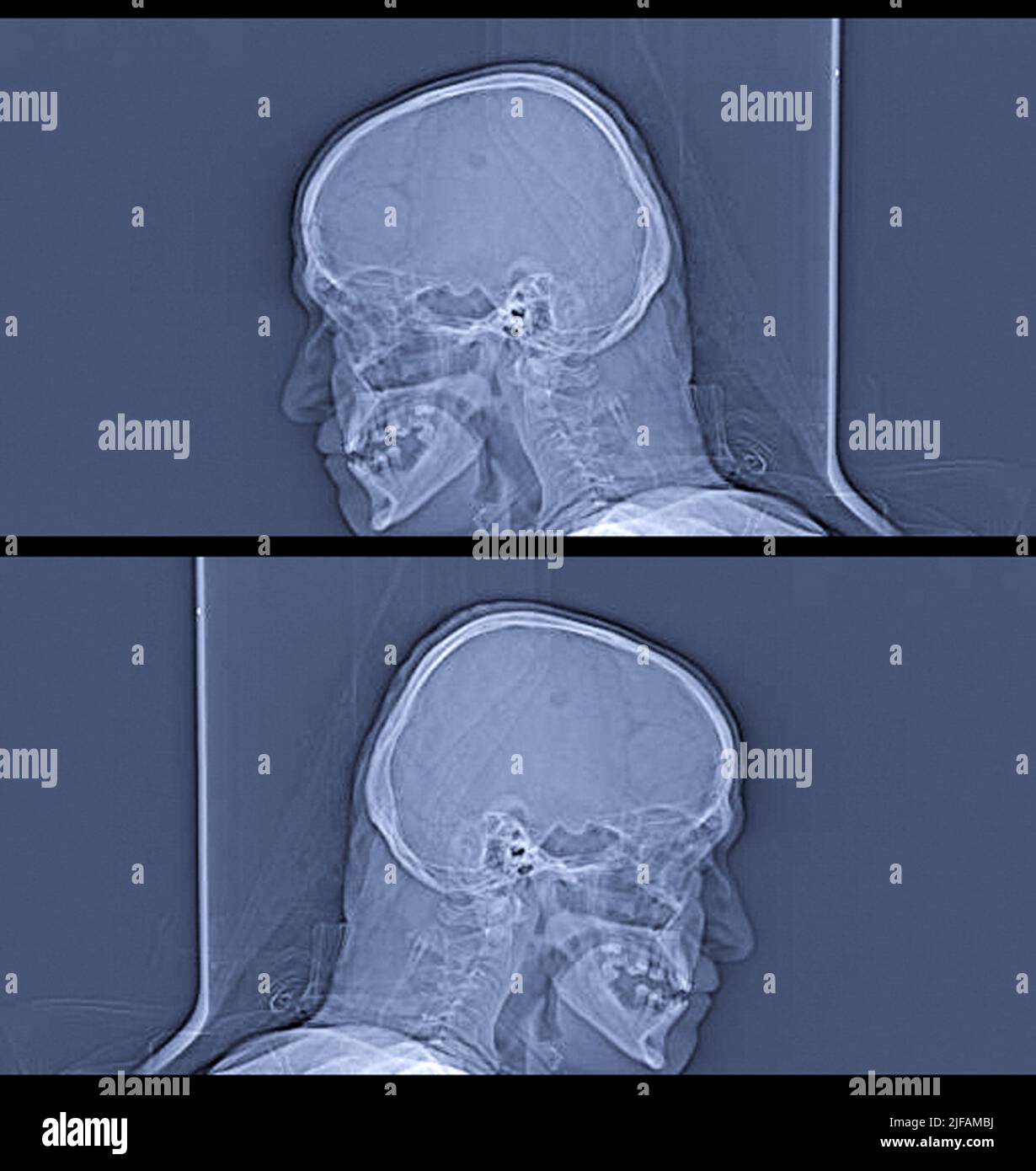 Medizinische radiologie -Fotos und -Bildmaterial in hoher Auflösung – Alamy