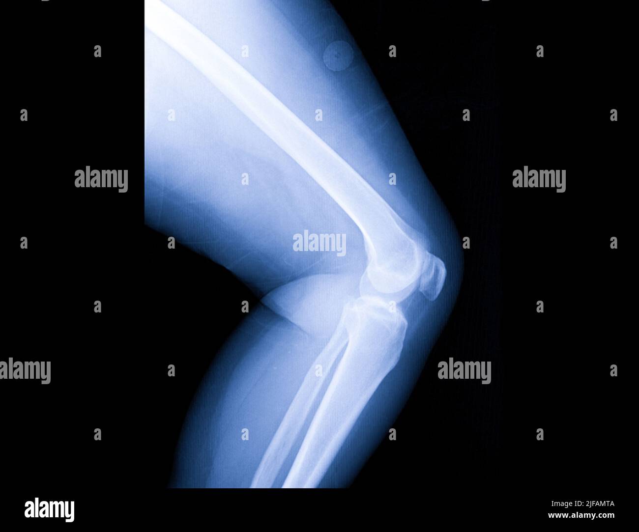 Radiologie röntgenaufnahme -Fotos und -Bildmaterial in hoher Auflösung ...