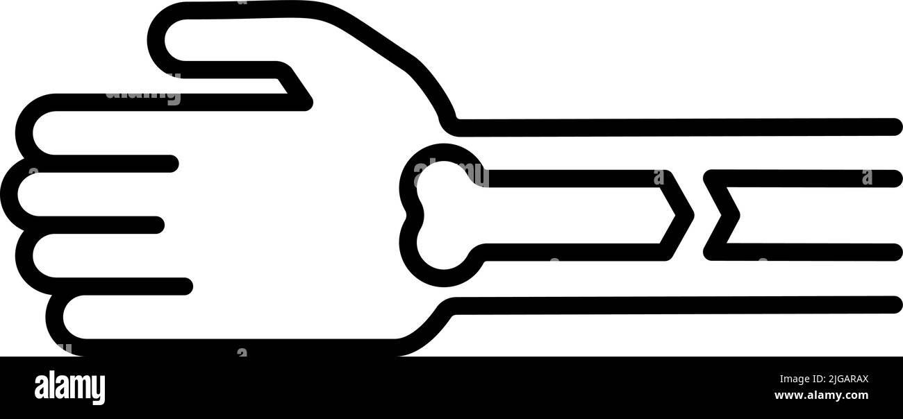 Fracture of the arm Schwarzweiß-Stockfotos und -bilder - Alamy