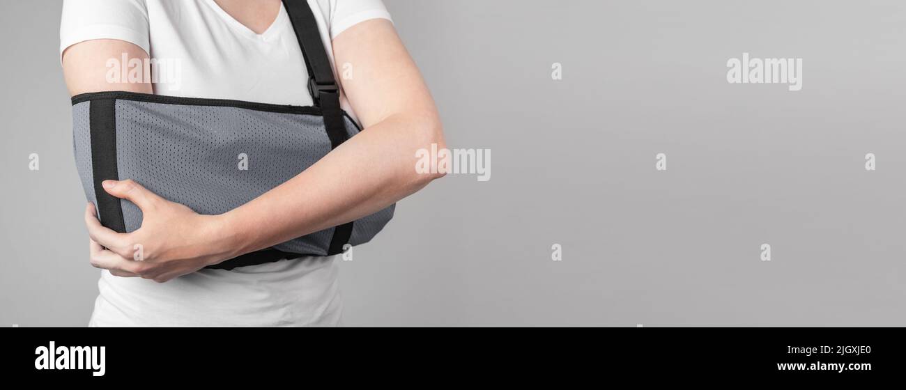 Gebrochener ellbogen -Fotos und -Bildmaterial in hoher Auflösung – Alamy