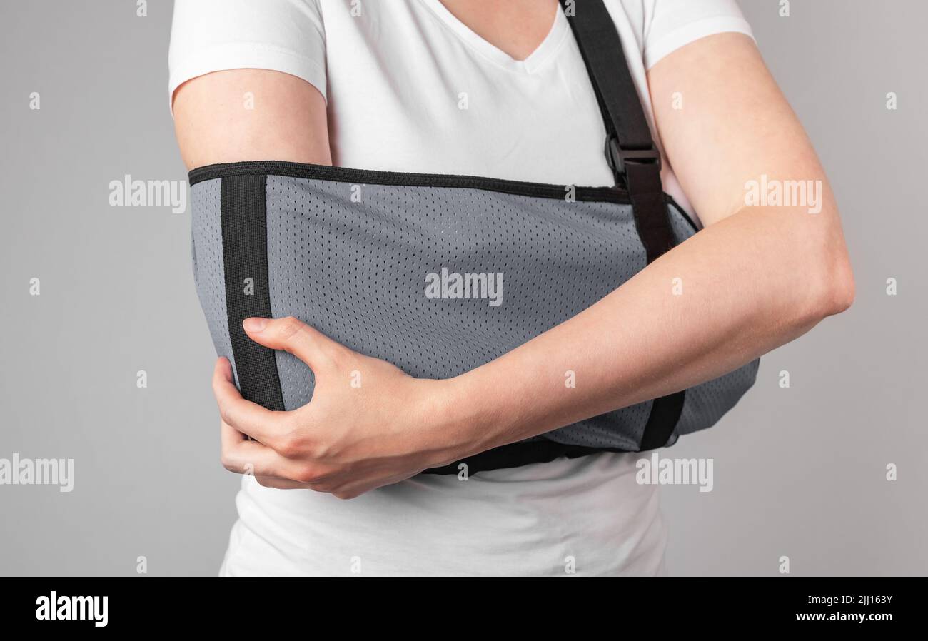 Gebrochener ellenbogen -Fotos und -Bildmaterial in hoher Auflösung – Alamy