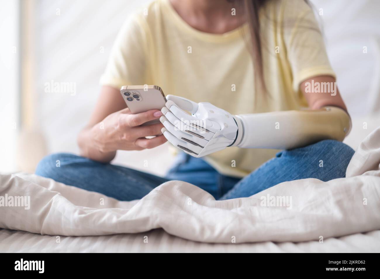 Mädchen mit bionischem Arm, das Telefon benutzt, soziale Medien liest ...