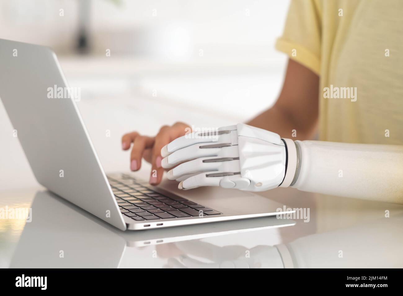 Motivierte Frau mit prothetischen Arm arbeiten Notebook-Computer, Text ...